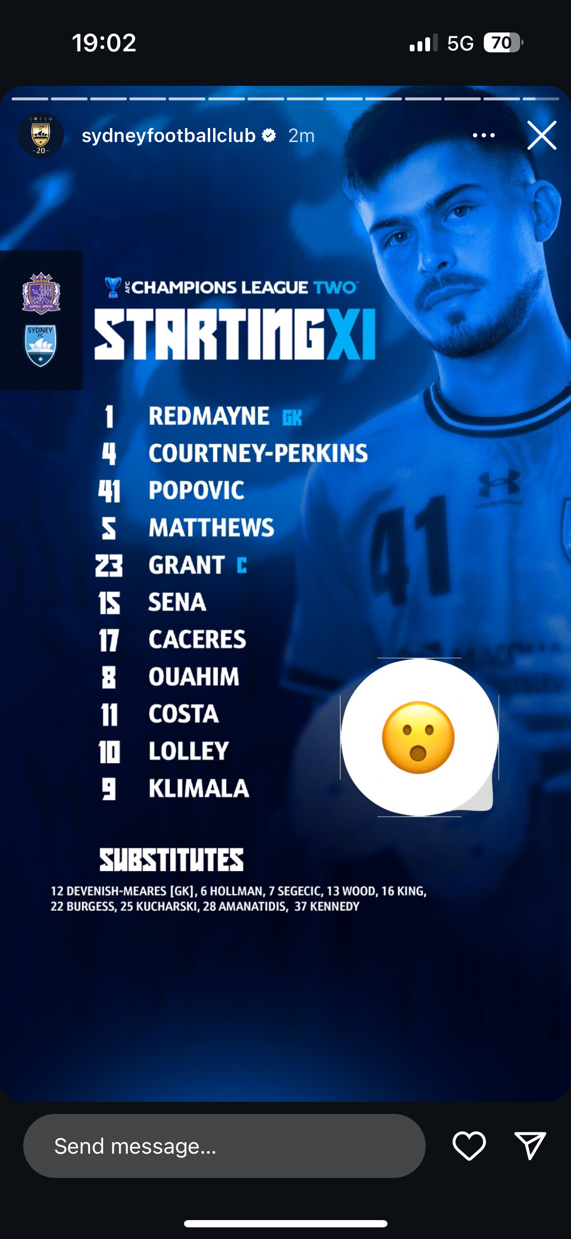 ACL2 - MD3 - Sanfrecce v SFC - Wed 23 Oct - Page 2 - The Cove - SFCU Forum
